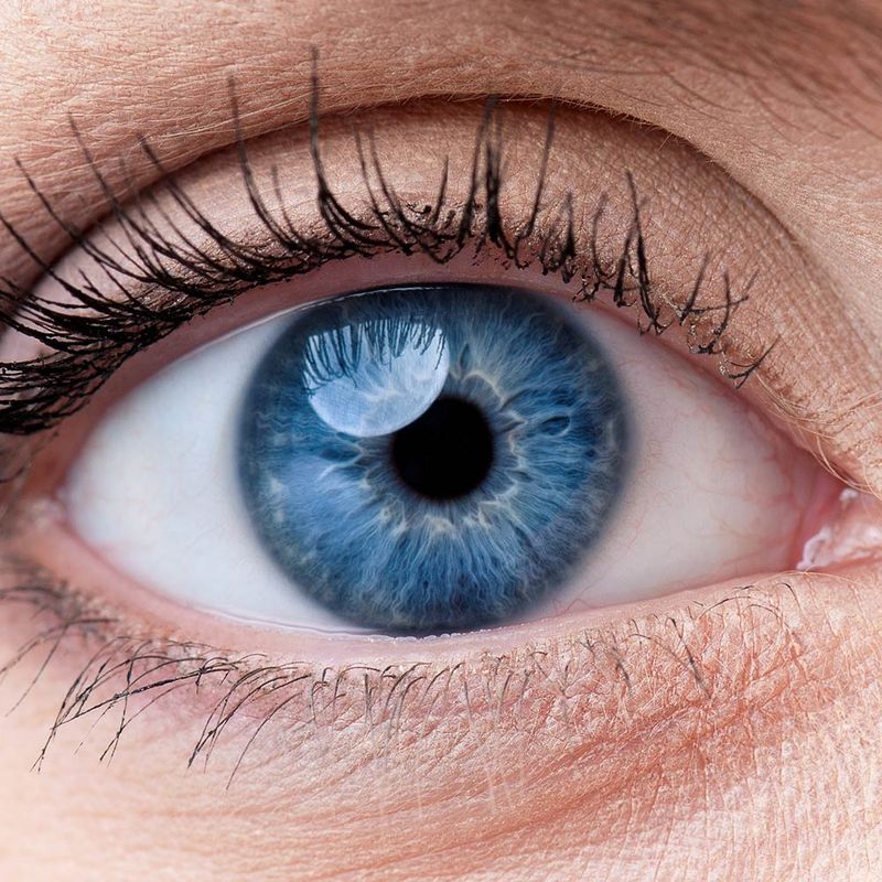 LASIK Eye Surgery San Francisco & Bay Area | IQ Laser Vision