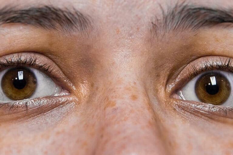Laser Eye Surgery: Addressing 5 Common Fears | IQ Laser Vision